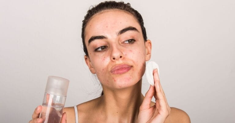 10 Ways on How to Reduce Oily Skin | Pureance