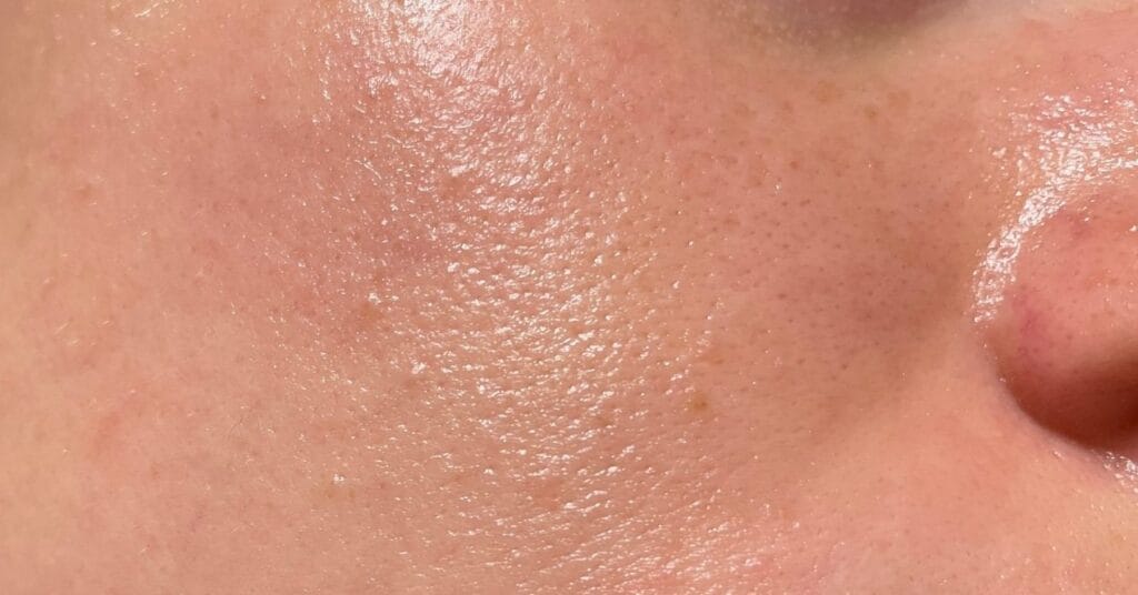 How to Tell if Skin Barrier Is Damaged: Top Warning Signs | Pureance